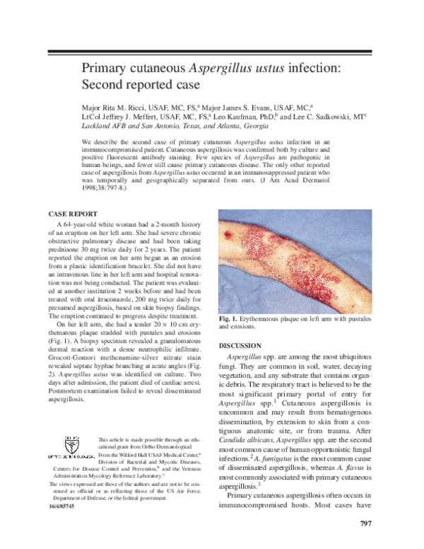 (PDF) Primary cutaneous Aspergillus ustus infection: Second reported ...