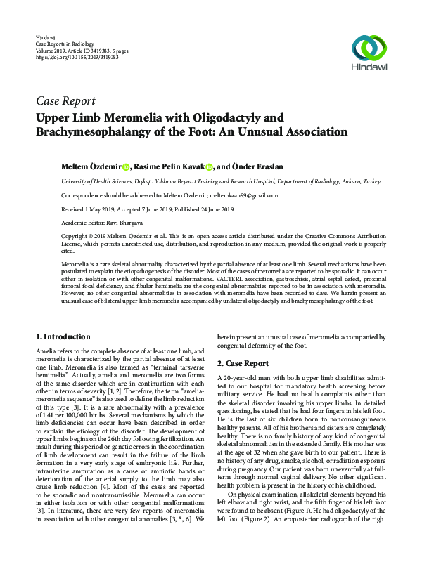 (PDF) Upper Limb Meromelia with Oligodactyly and Brachymesophalangy of ...