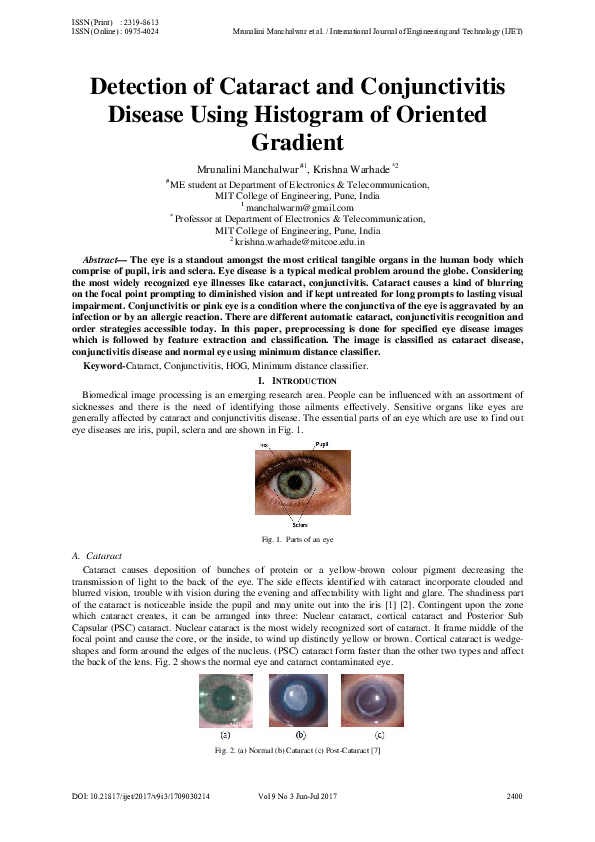 (PDF) Detection of Cataract and Conjunctivitis Disease Using Histogram ...