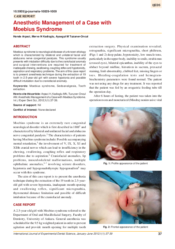 (PDF) Anesthesic Management of a Case with Moebius Syndrome