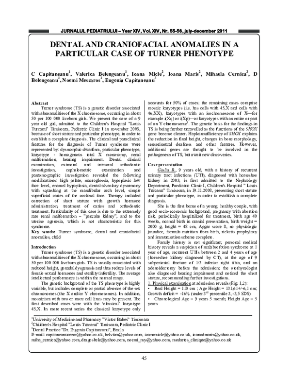 (PDF) Dental and Craniofacial Anomalies in a Particular Case of Turner ...
