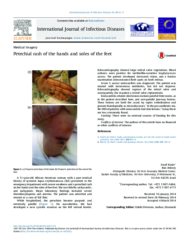 (PDF) Petechial rash of the hands and soles of the feet