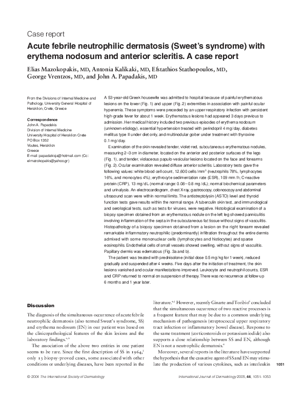 (PDF) Acute febrile neutrophilic dermatosis (Sweet's syndrome) with ...