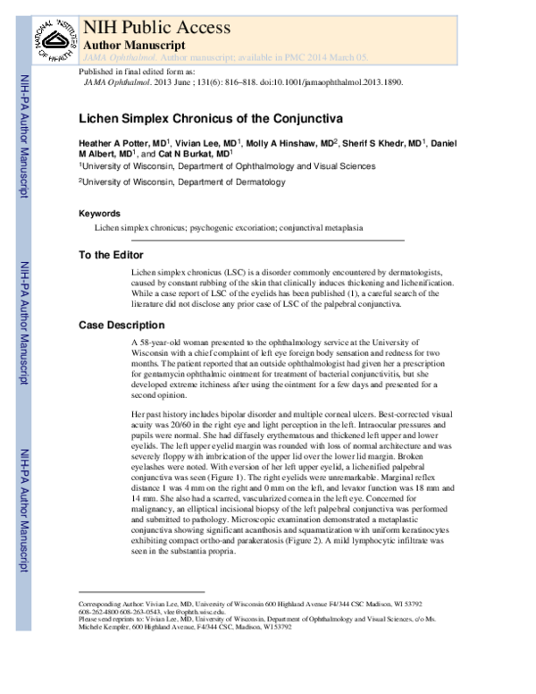 (PDF) Lichen Simplex Chronicus of the Conjunctiva
