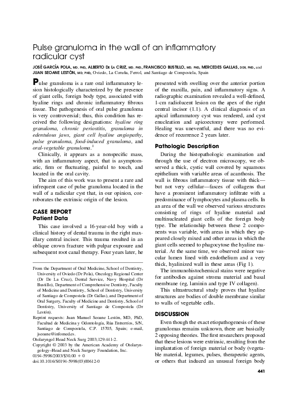 (PDF) Pulse granuloma in the wall of an inflammatory radicular cyst