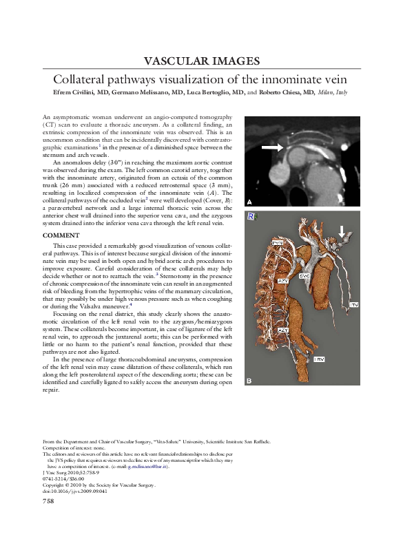 (PDF) Collateral pathways visualization of the innominate vein