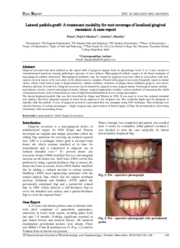 (PDF) Lateral pedicle graft: A treatment modality for root coverage of ...