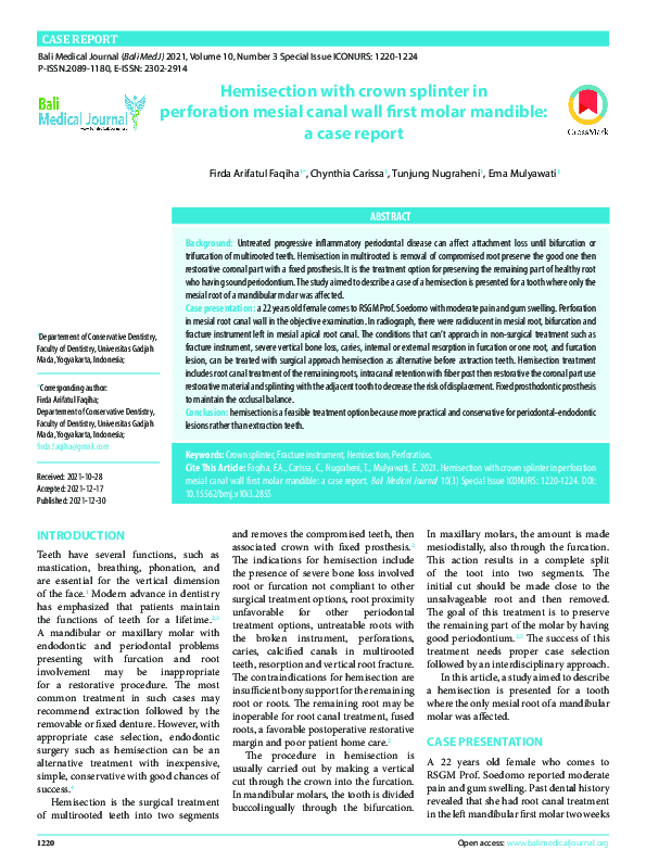 (PDF) Hemisection with crown splinter in perforation mesial canal wall ...