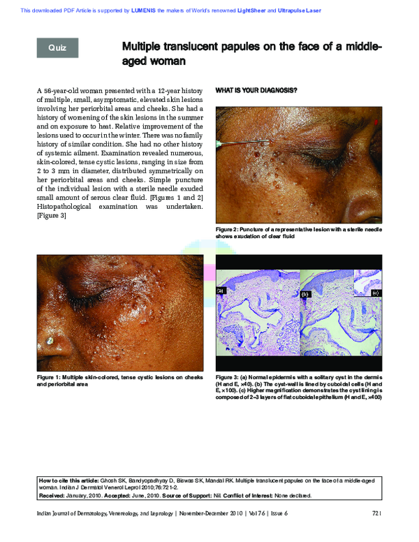 (PDF) Multiple translucent papules on the face of a middle-aged woman
