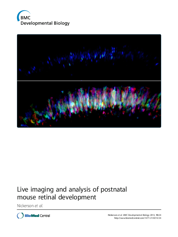 (PDF) Live imaging and analysis of postnatal mouse retinal development ...