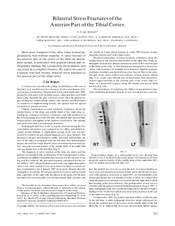 (PDF) Bilateral Stress Fractures of the Anterior Part of the Tibial ...