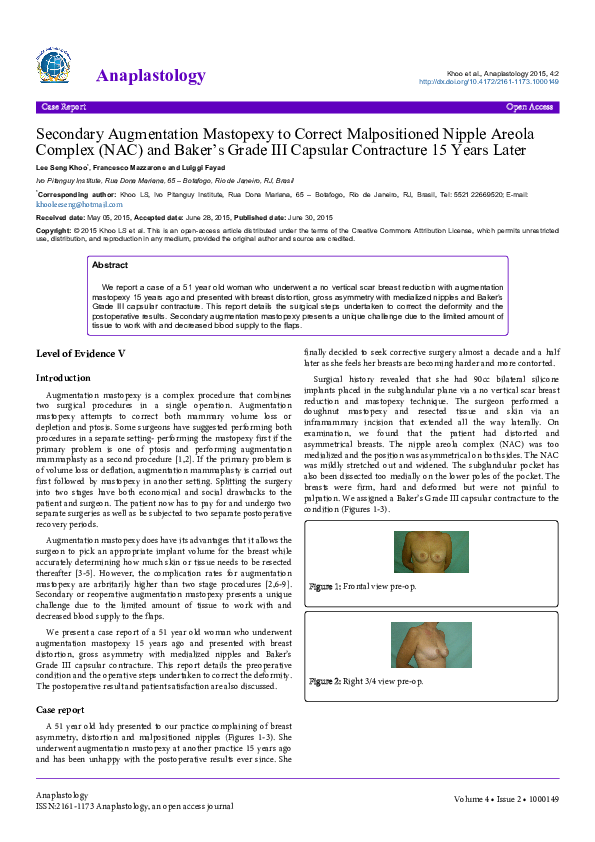 (PDF) Secondary Augmentation Mastopexy to Correct Malpositioned Nipple ...