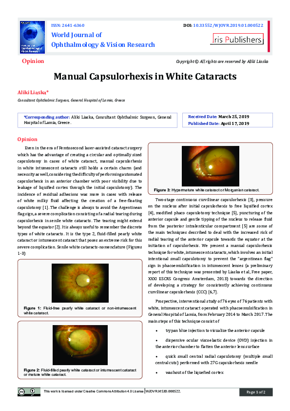 (PDF) Manual Capsulorhexis in White Cataracts