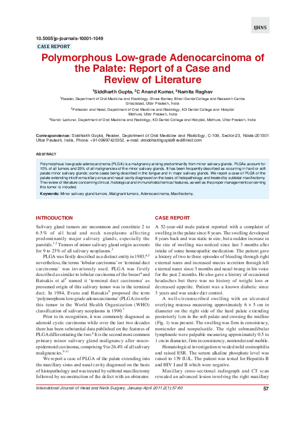 (PDF) Polymorphous Low-Grade Adenocarcinoma of Palate