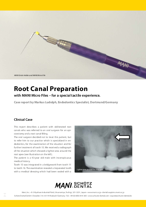 (PDF) [Root canal preparation]