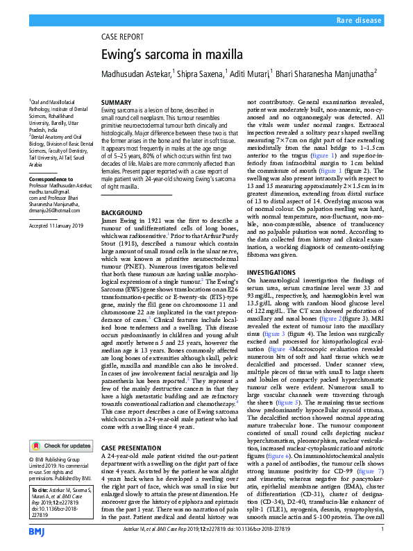 (PDF) Ewing’s Sarcoma Case in 24-Year-Old Male Maxilla