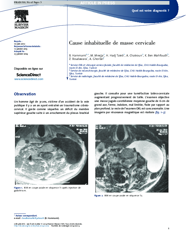 (PDF) Cause inhabituelle de masse cervicale | Bouthaina Hammami ...