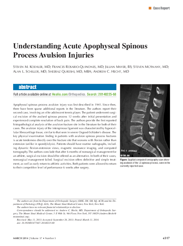 (PDF) Understanding Acute Apophyseal Spinous Process Avulsion Injuries