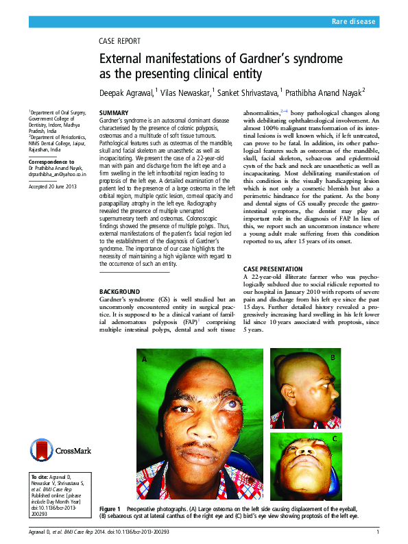 (PDF) External manifestations of Gardner's syndrome as the presenting ...