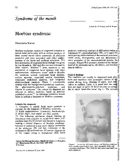 (PDF) Moebius syndrome