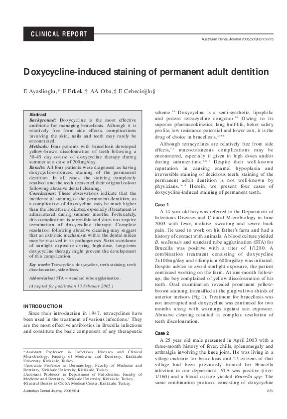 (PDF) Doxycycline-induced staining of permanent adult dentition