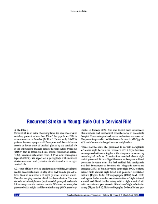 (PDF) Recurrent stroke in young: Rule out a cervical rib!