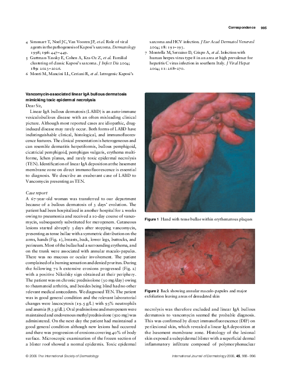 (PDF) Vancomycin-Associated Linear IgA Bullous Dermatosis