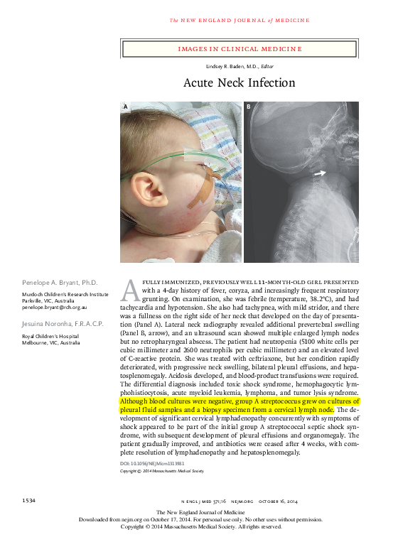(PDF) Acute Neck Infection