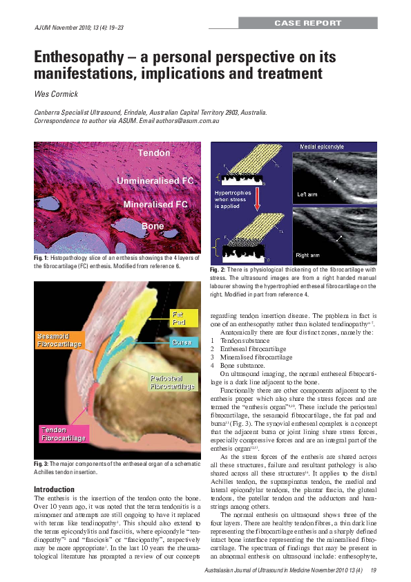 (PDF) Enthesopathy - a personal perspective on its manifestations ...