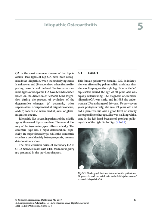 (PDF) Idiopathic Osteoarthritis