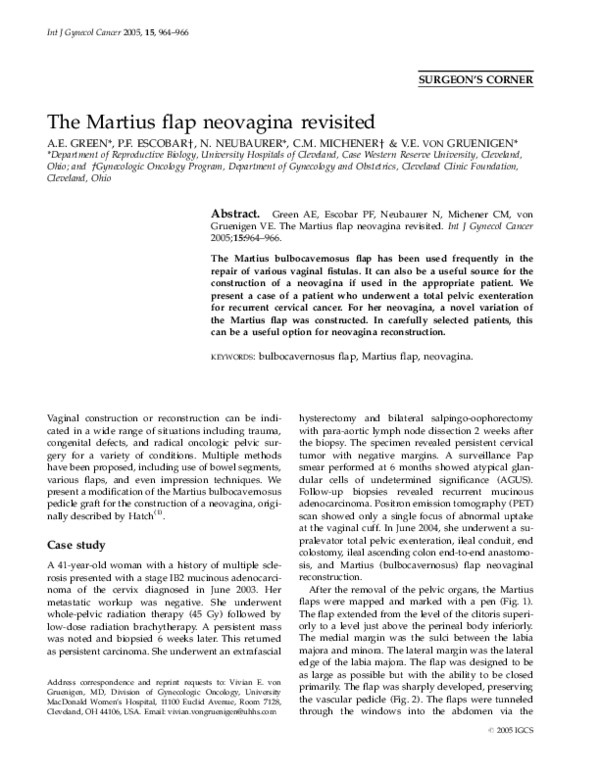 (PDF) Novel Martius Flap for Neovagina Reconstruction
