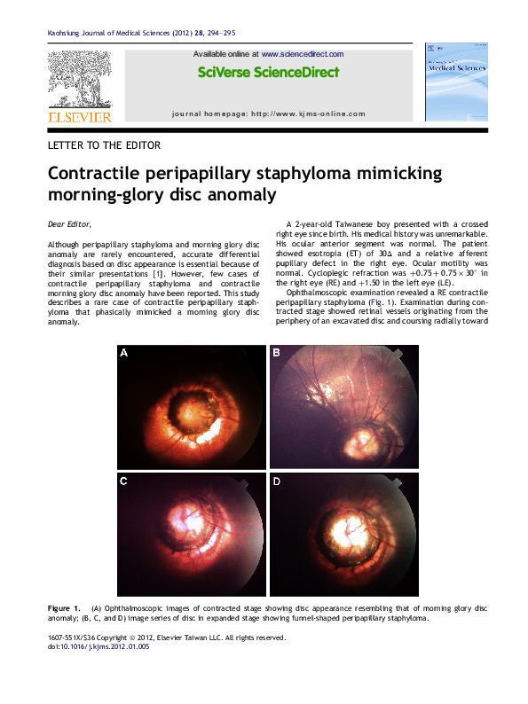 (PDF) Contractile peripapillary staphyloma mimicking morning-glory disc ...