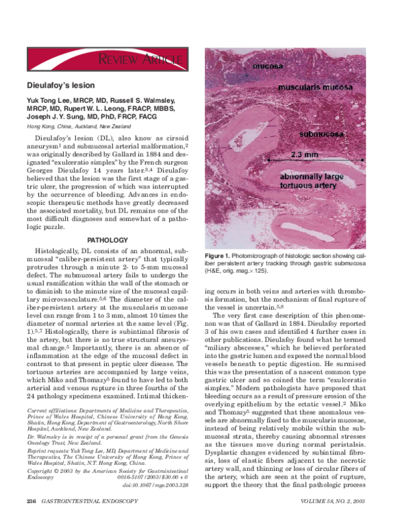 (PDF) Melena Secondary to Duodenal Dieulafoy’s Lesion: A Rare Case ...