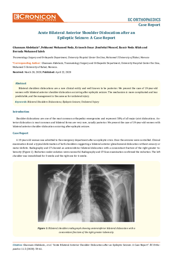 Anterior Shoulder Dislocation Mechanism Of Injury