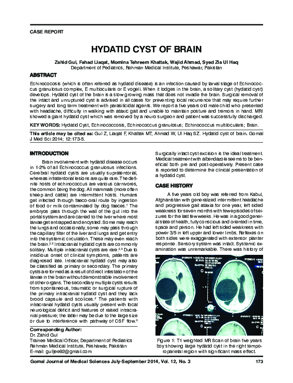 (PDF) Hydatid Cyst of Brain