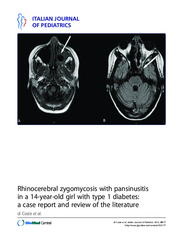 (PDF) Rhinocerebral zygomycosis with pansinusitis in a 14-year-old girl ...