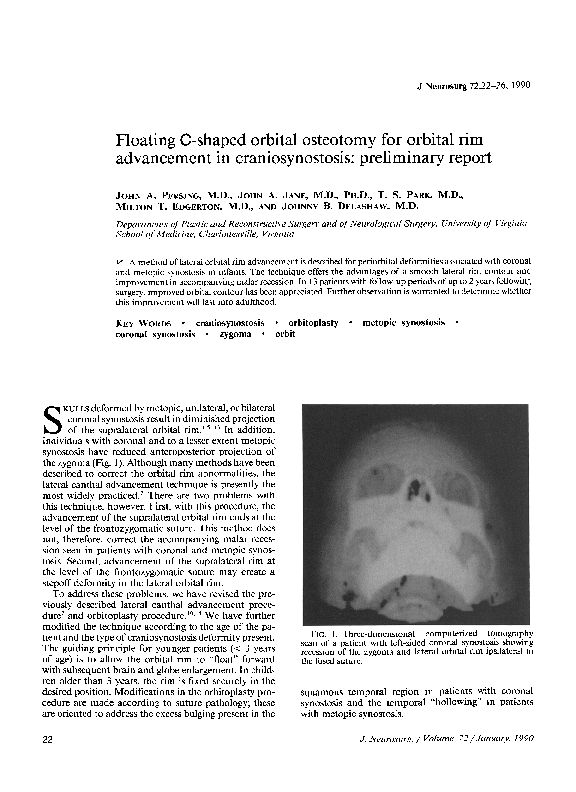 (PDF) Floating C-shaped orbital osteotomy for orbital rim advancement ...