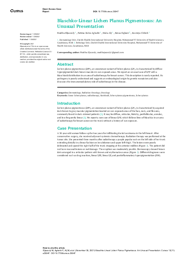 (PDF) Blaschko-Linear Lichen Planus Pigmentosus: An Unusual Presentation | kenza oqbani ...