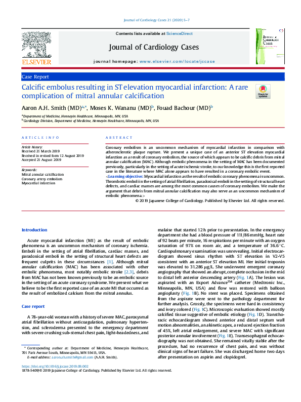 (PDF) Calcific embolus resulting in ST elevation myocardial infarction ...