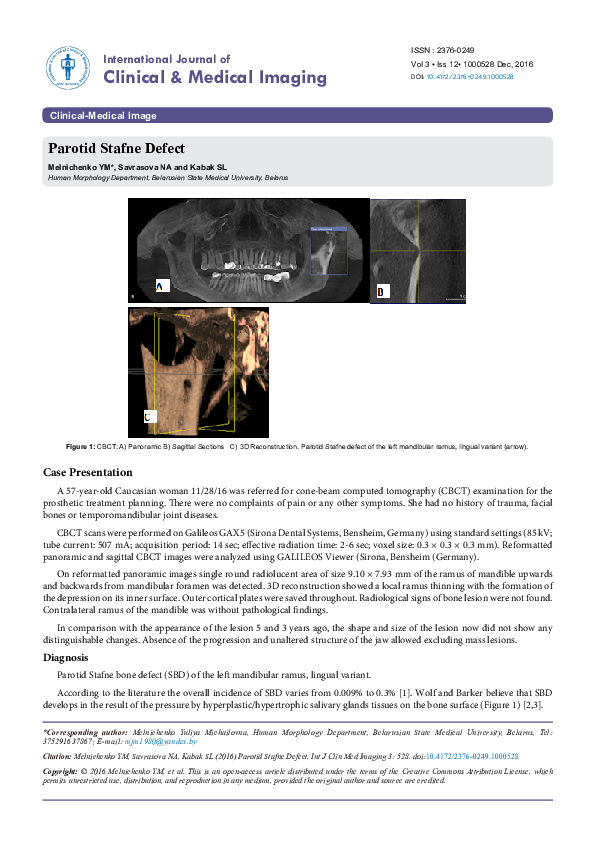 (PDF) Parotid Stafne Defect