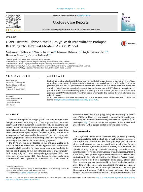 (PDF) Giant Ureteral Fibroepithelial Polyp with Intermittent Prolapse ...