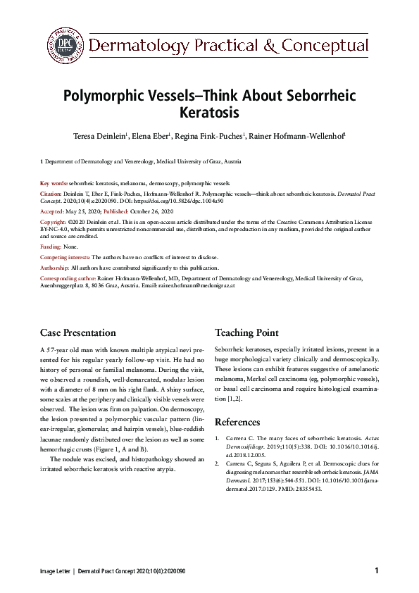 (PDF) Polymorphic Vessels—Think About Seborrheic Keratosis