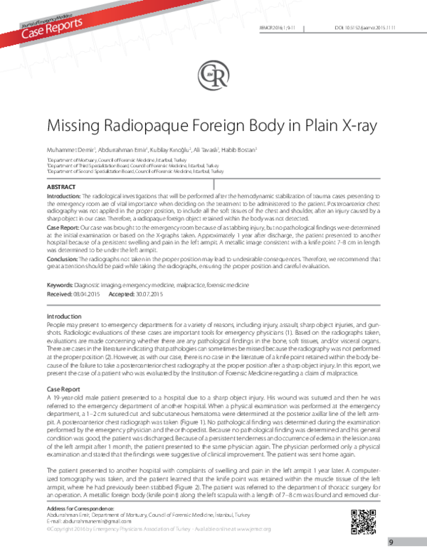 (PDF) Missing Radiopaque Foreign Body in Plain X-ray | Habib Bostan ...