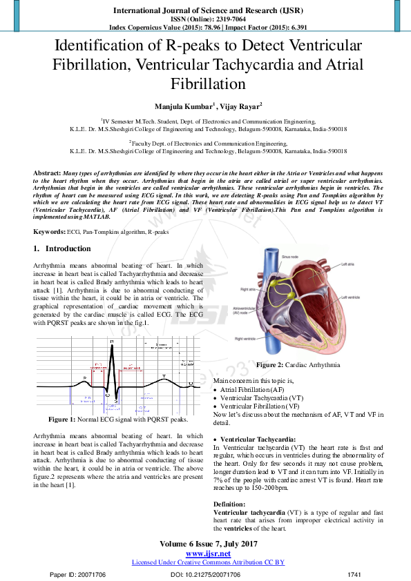 (PDF) Identification of R-peaks to Detect Ventricular Fibrillation ...