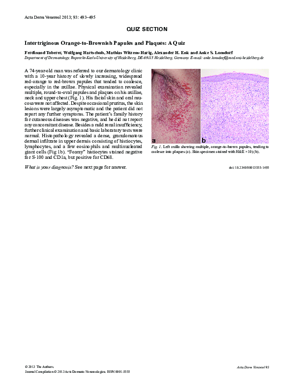 (PDF) Intertriginous Orange-to-Brownish Papules and Plaques: A Quiz ...