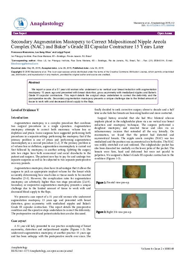 (PDF) Secondary Augmentation Mastopexy to Correct Malpositioned Nipple ...