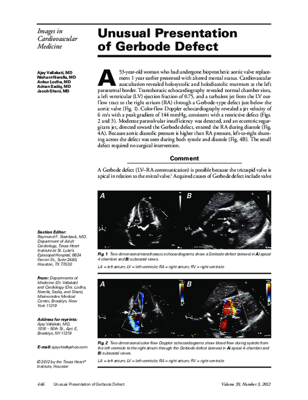 (PDF) Unusual presentation of Gerbode defect | Jacob Shani - Academia.edu