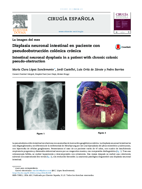 (PDF) Displasia neuronal intestinal en paciente con pseudoobstrucción ...