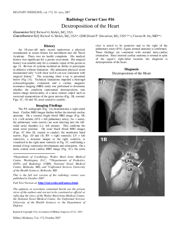 (PDF) Radiology corner. Dextroposition of the heart