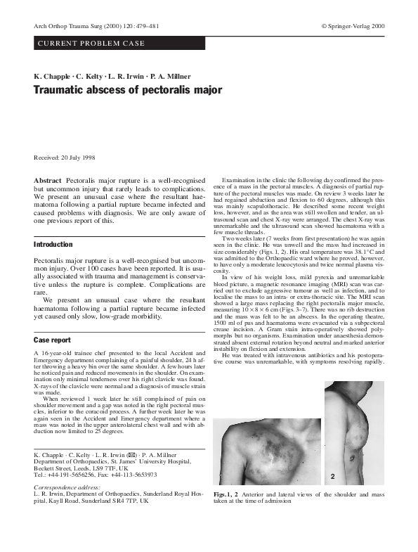 (PDF) Traumatic abscess of pectoralis major | Keith Chapple - Academia.edu